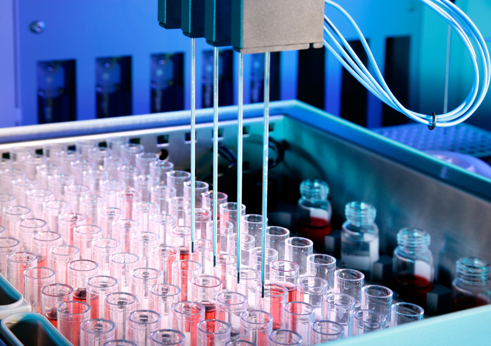 Stratec springt ins Depot